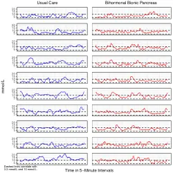 The Bihormonal Bionic Pancreas Improves Glycemic Control in Individuals ...