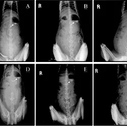 (A–F) X-rays demonstrating the position of the floating barium sulfate ...